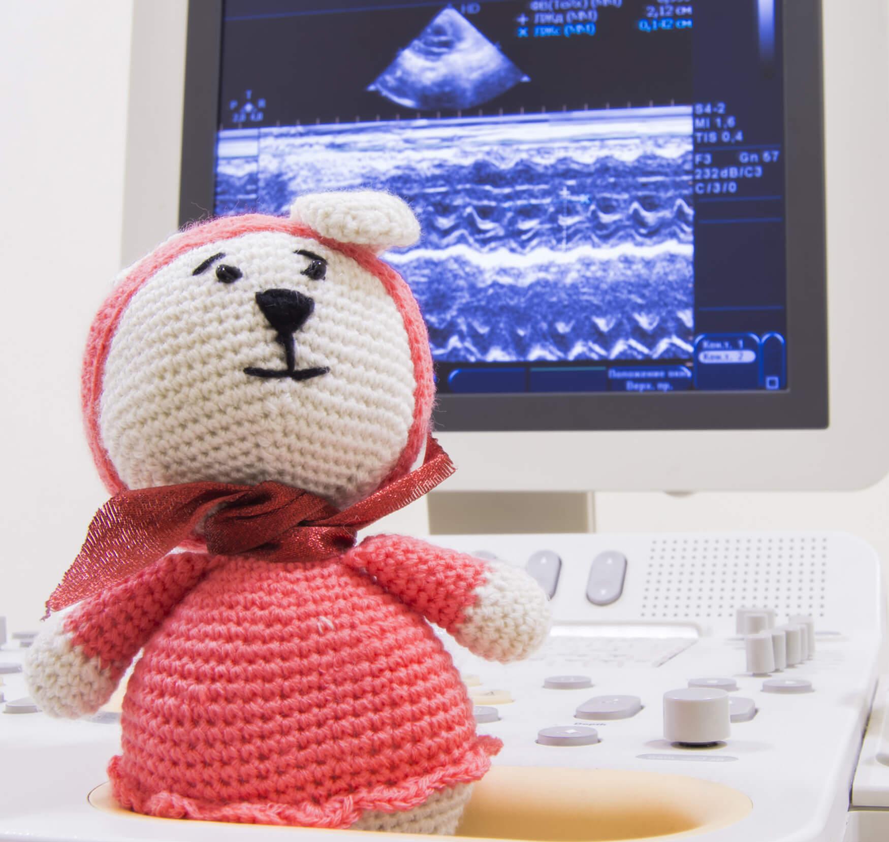 2-D Echo pediatric - Care Center