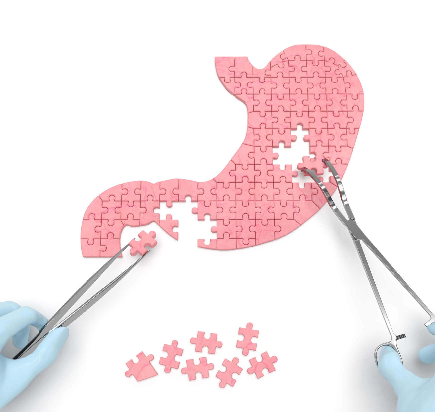Gastro surgery - Care Center
